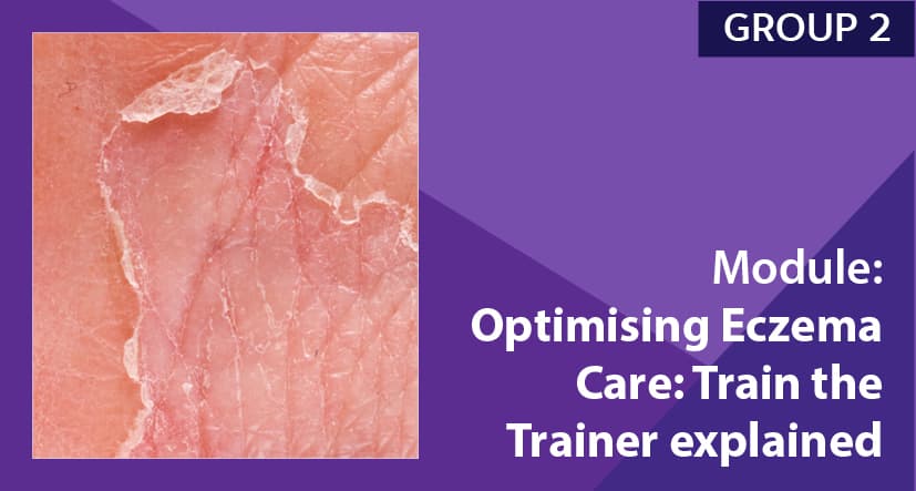 Eczema (Atopic dermatitis) - Pharmaceutical Society of Australia